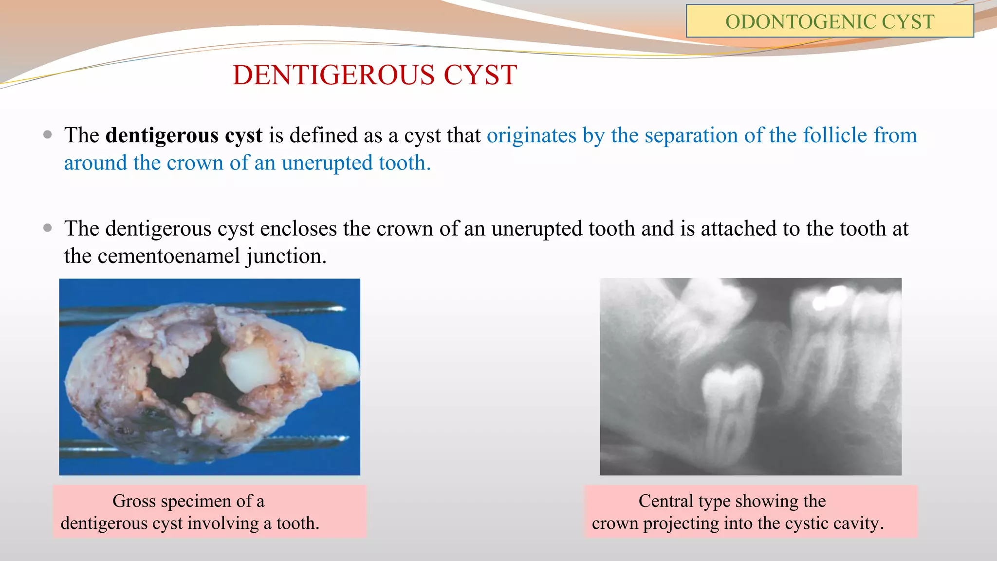 Clinical consideration in tooth development, eruption and shedding | PPTX