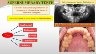 Clinical consideration in tooth development, eruption and shedding | PPTX