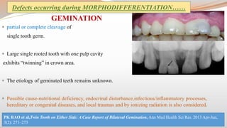 Clinical consideration in tooth development, eruption and shedding | PPTX