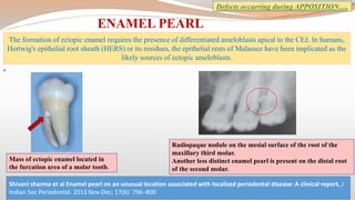 Clinical consideration in tooth development, eruption and shedding | PPTX