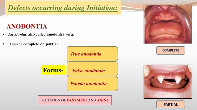 Clinical consideration in tooth development, eruption and shedding
