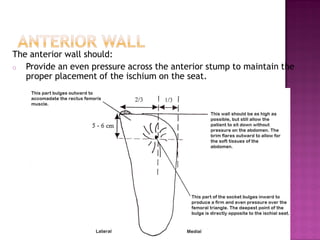 Clinical consideration of quadrilateral socket 2000 | PDF