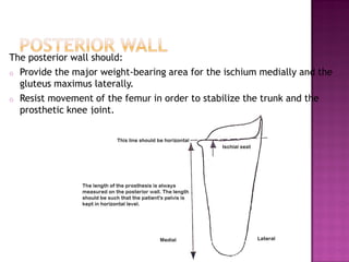 Clinical consideration of quadrilateral socket 2000 | PDF