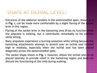 Clinical consideration of quadrilateral socket 2000 | PDF