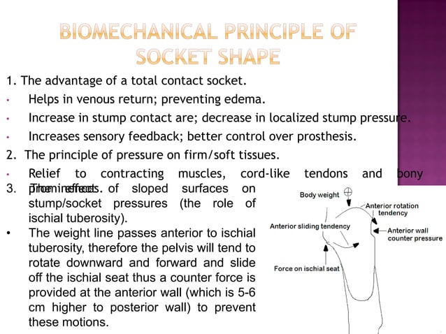 Clinical consideration of quadrilateral socket 2000 | PDF