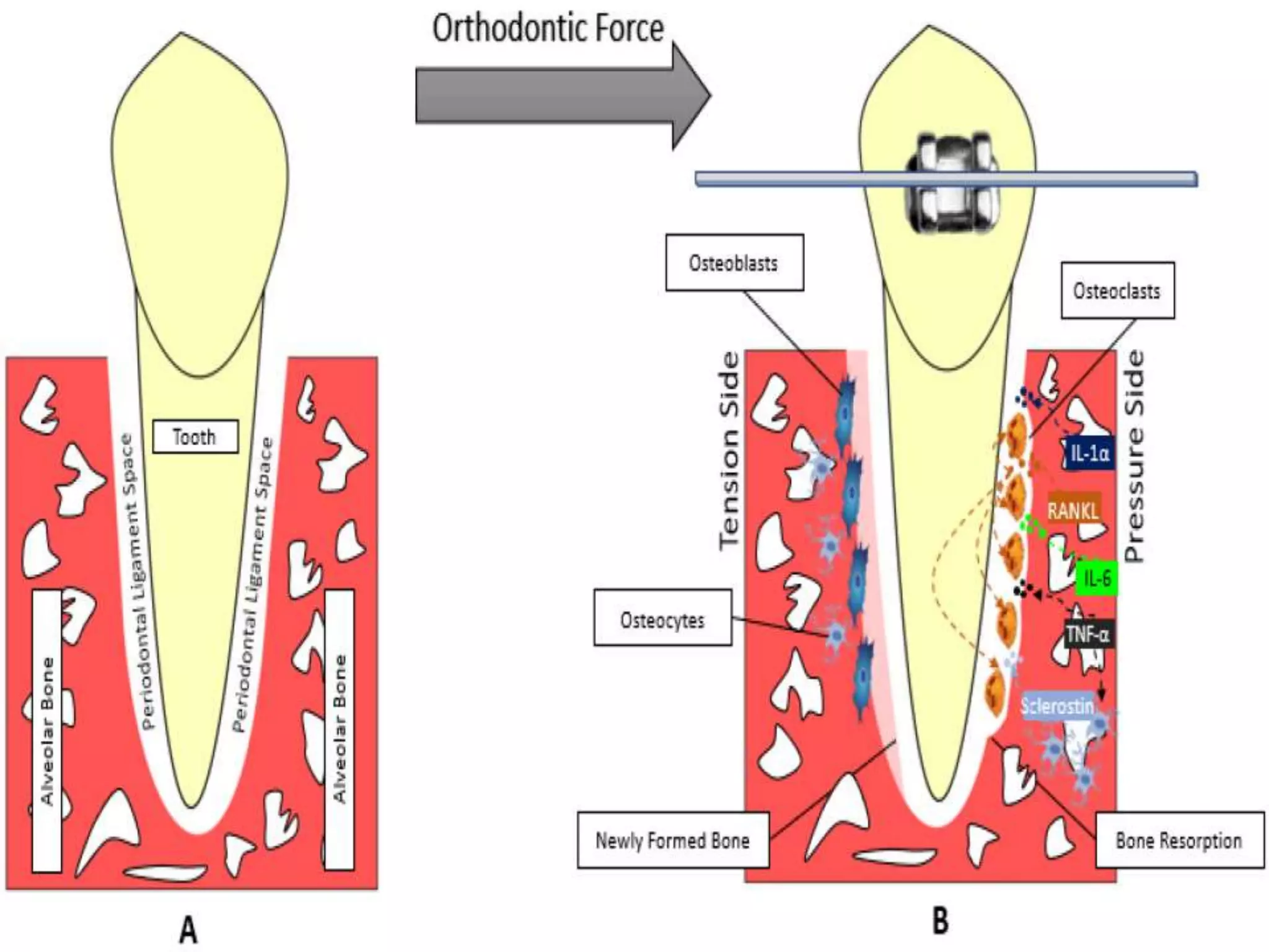 Clinical considerations of periodontal ligament | PPTX