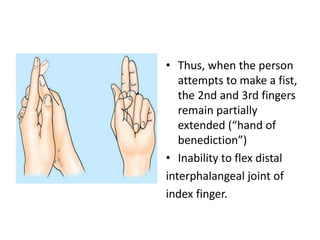 Clinical correlation of forearm | PPTX