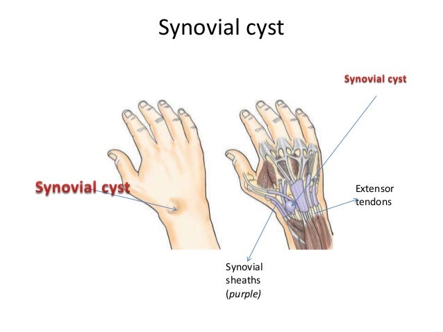 Clinical correlation of forearm