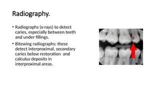clinical diagnosis and histological presentation of dental caries (1).pptx