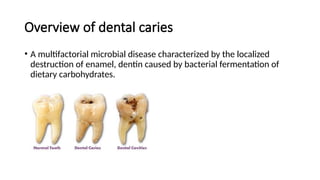 clinical diagnosis and histological presentation of dental caries (1).pptx