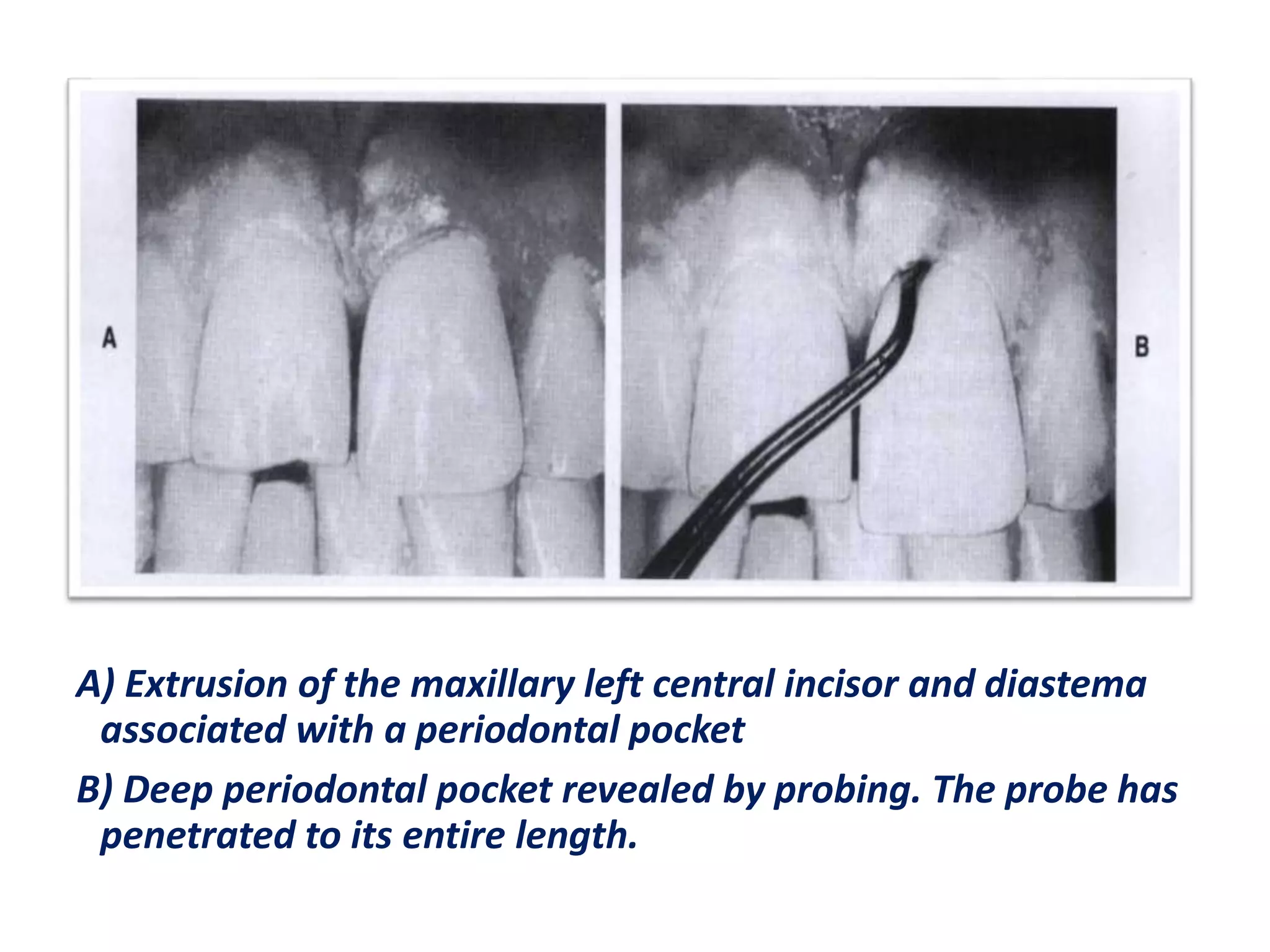 Clinical diagnosis in periodontology | PPTX