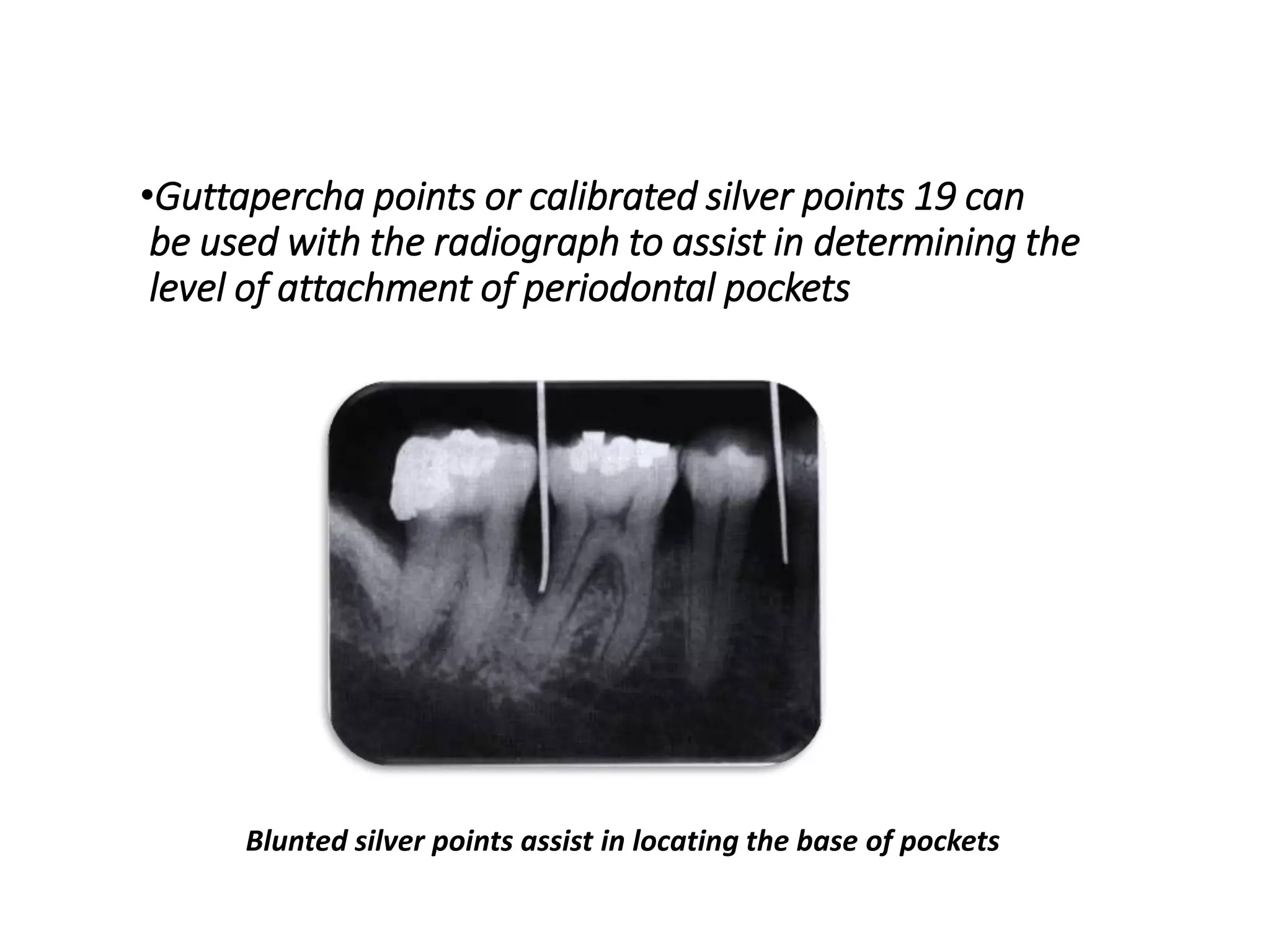 Clinical diagnosis in periodontology | PPTX