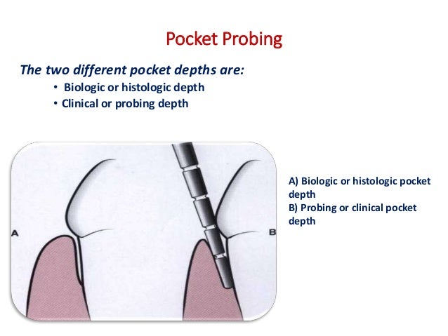 Clinical diagnosis in periodontology