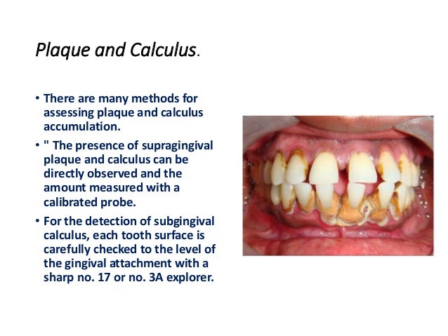 Clinical diagnosis in periodontology