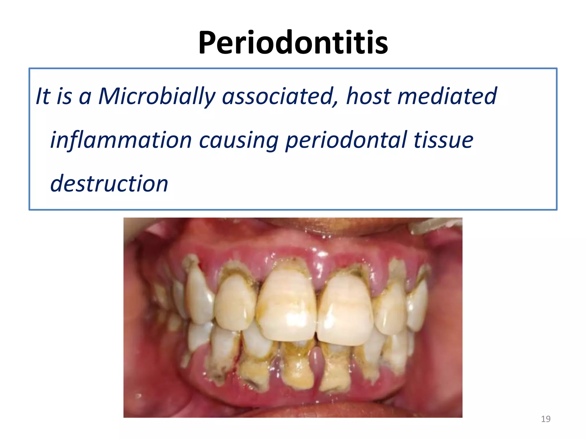 Clinical diagnosis of periodontal diseases | PPTX