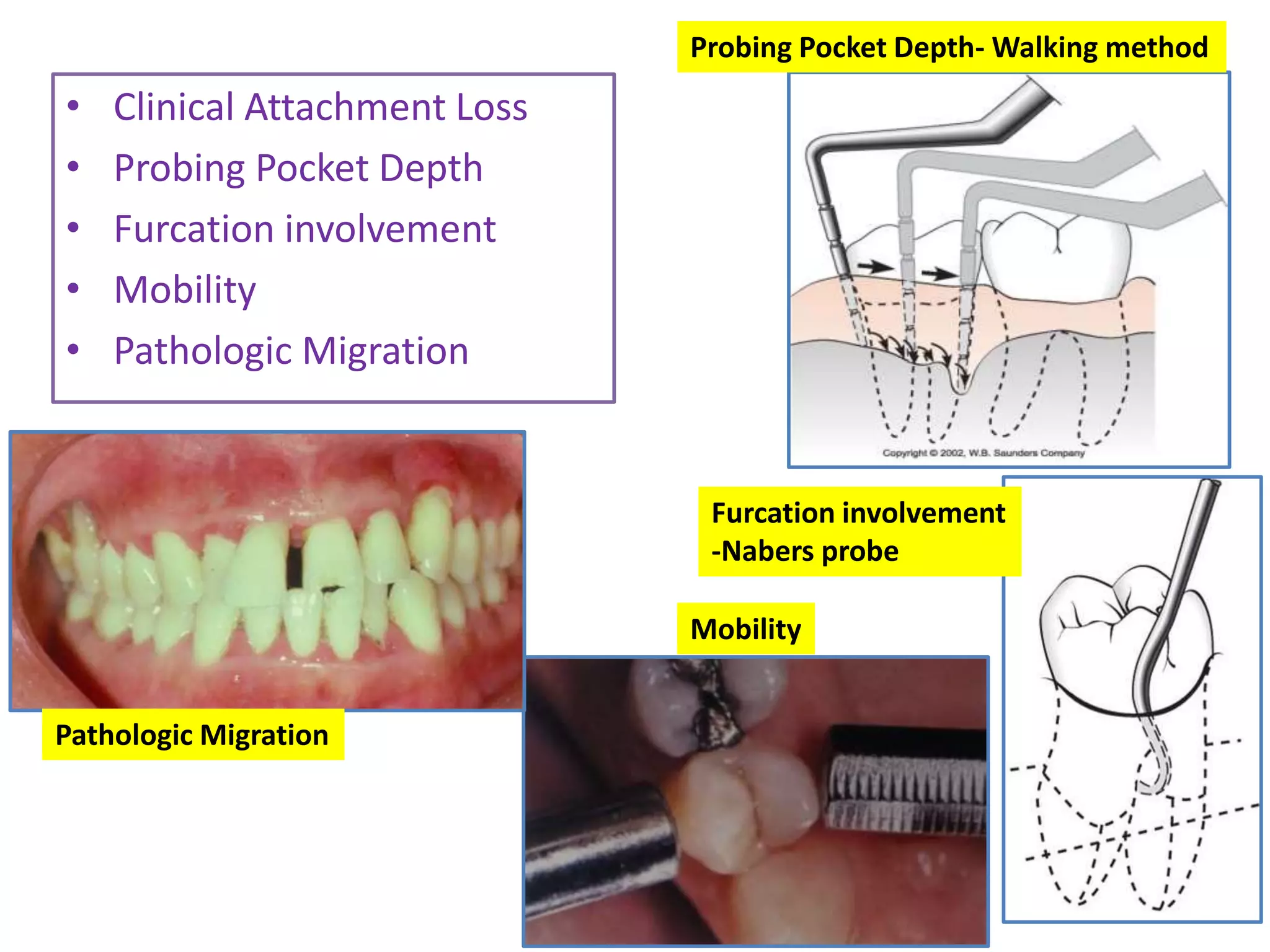 Clinical diagnosis of periodontal diseases | PPTX