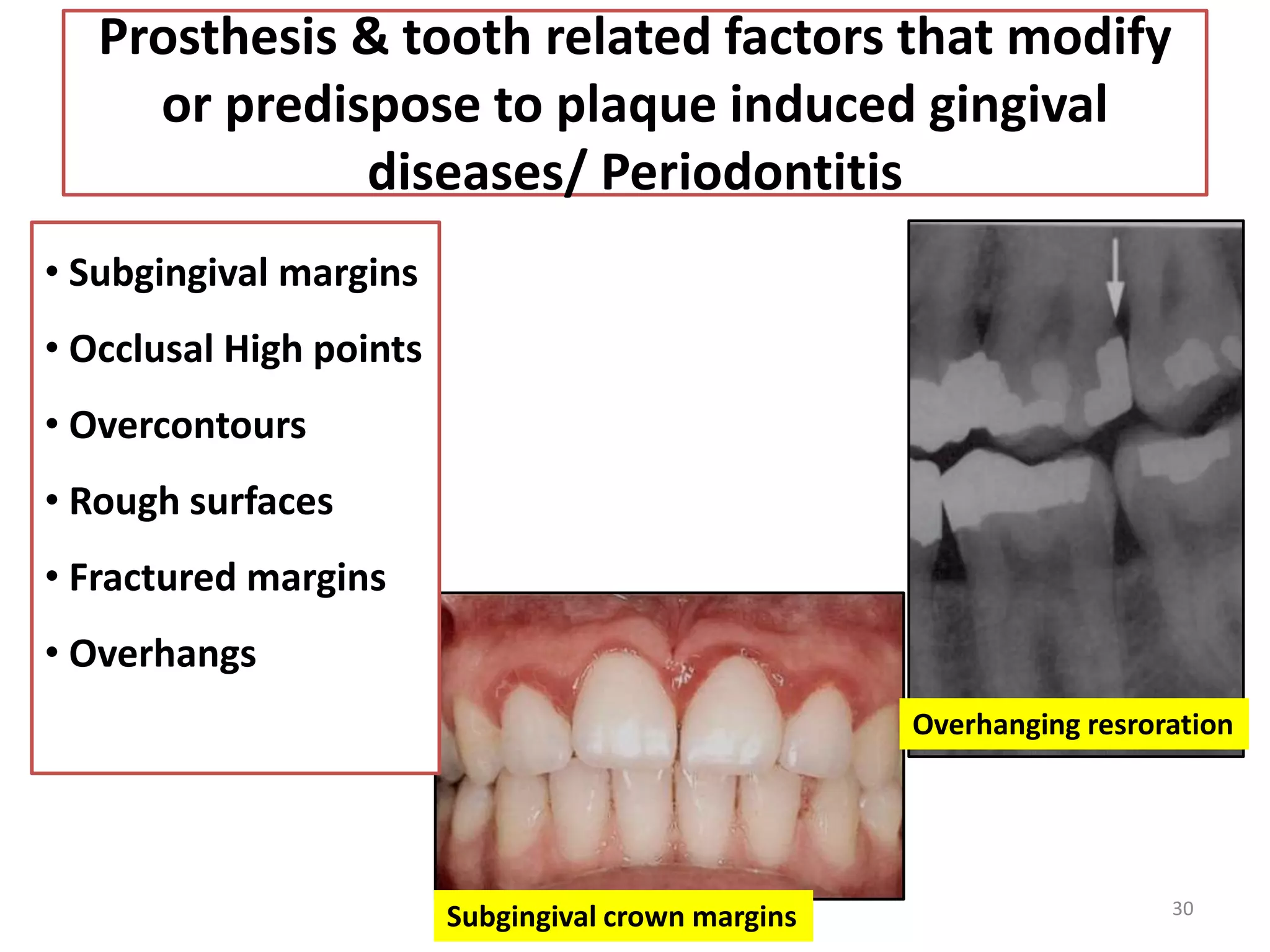 Clinical diagnosis of periodontal diseases | PPTX