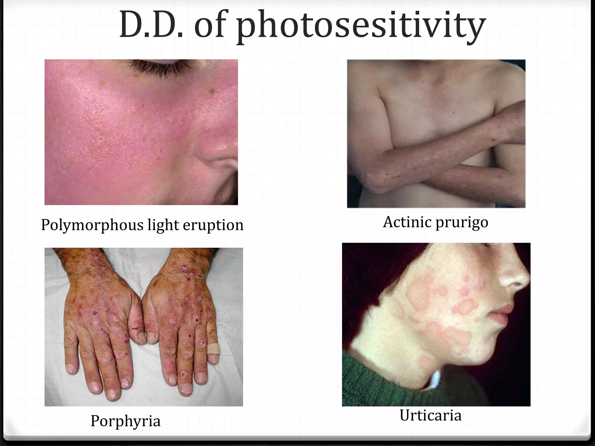 Clinical diagnosis of systemic lupus erythematosus | PDF