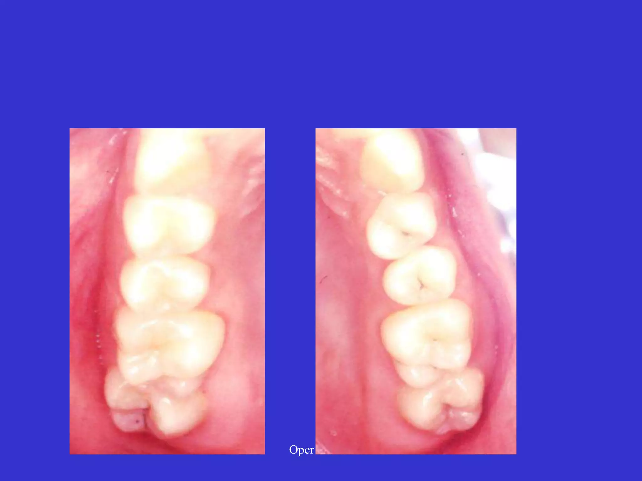 Clinical Diagnosis of Tooth Defects and Treatment Plan.ppt