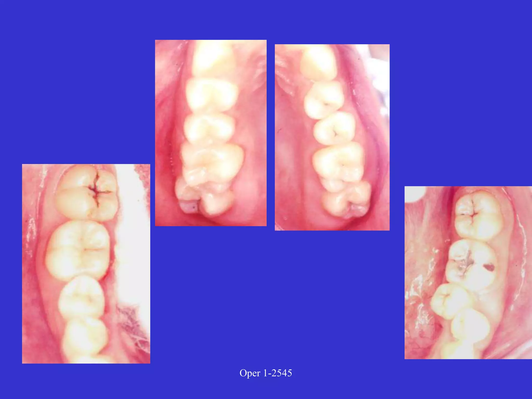 Clinical Diagnosis of Tooth Defects and Treatment Plan.ppt