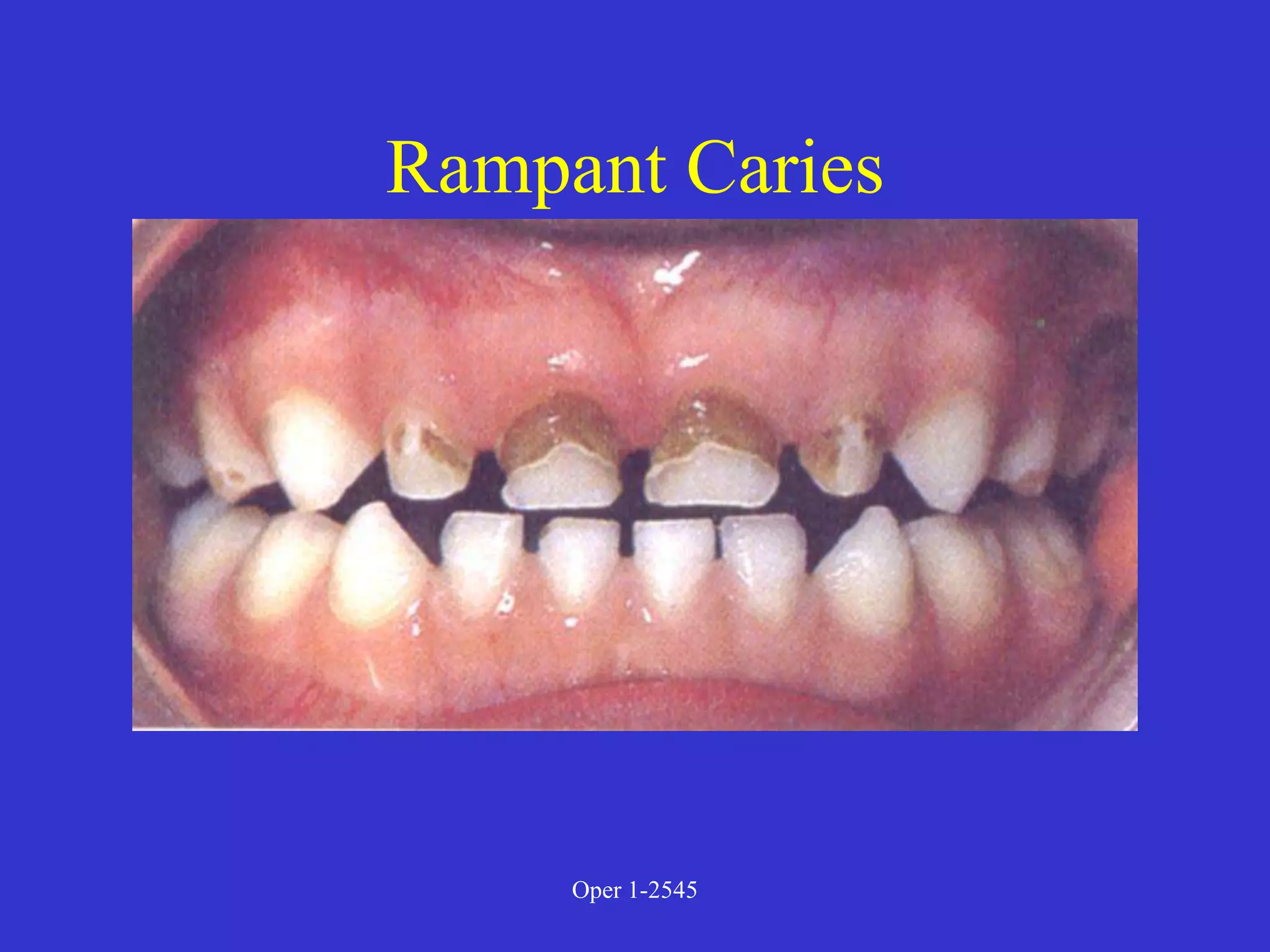 Clinical Diagnosis of Tooth Defects and Treatment Plan.ppt