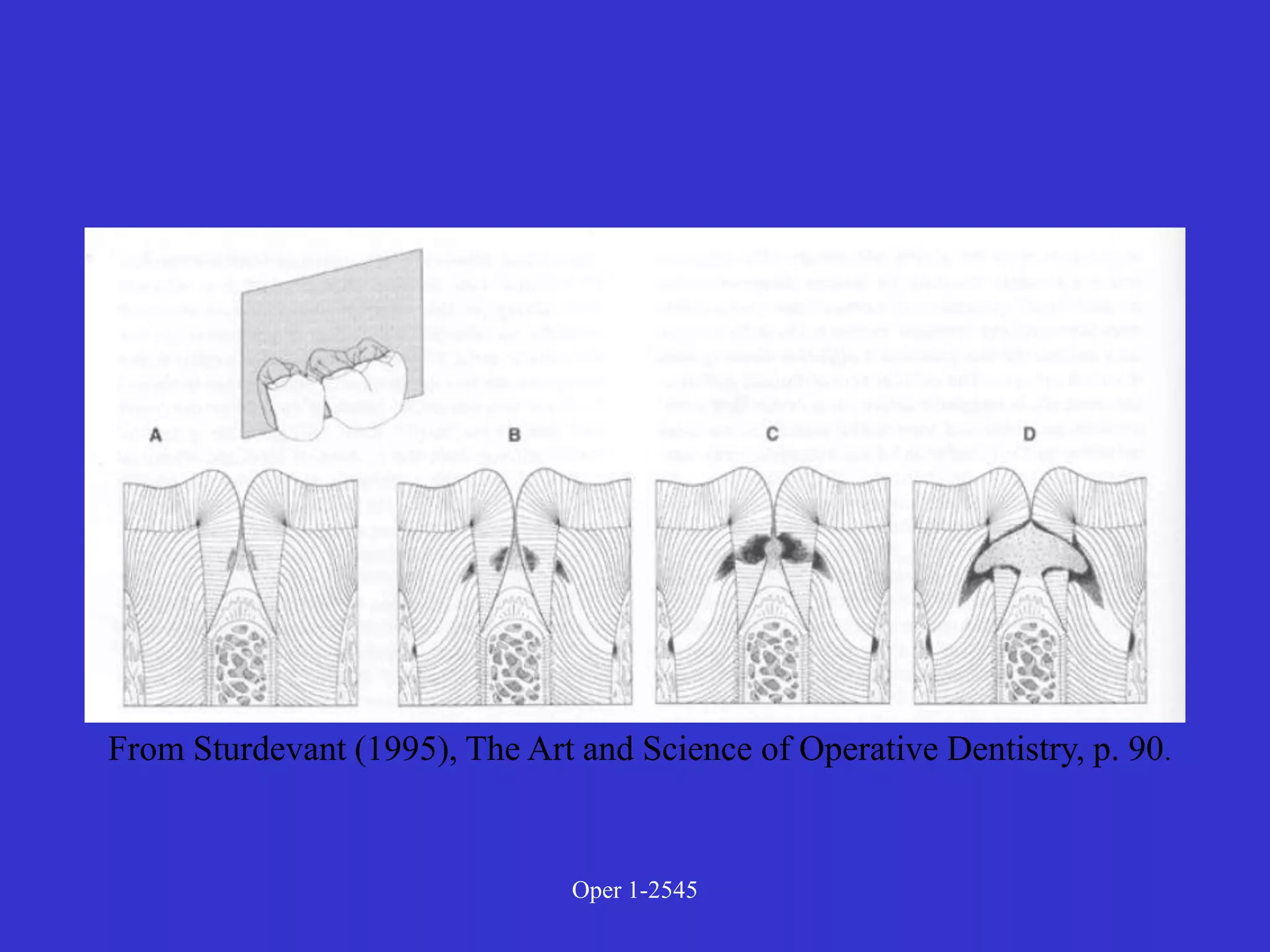 Clinical Diagnosis of Tooth Defects and Treatment Plan.ppt