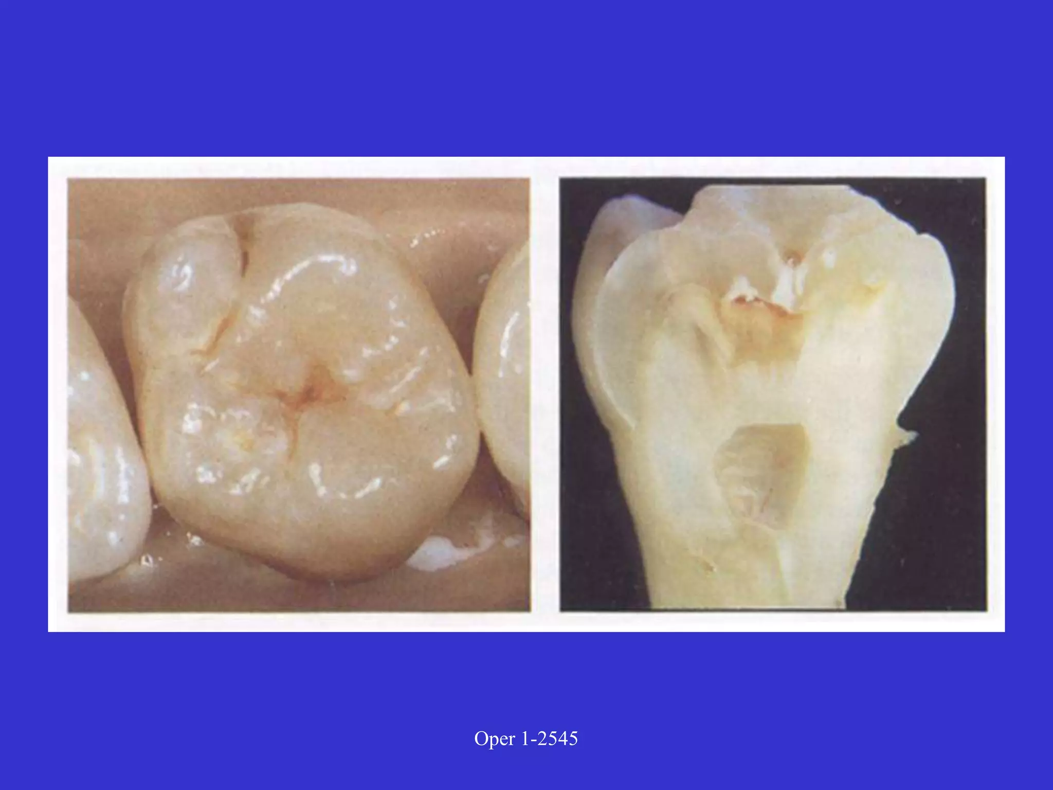 Clinical Diagnosis of Tooth Defects and Treatment Plan.ppt