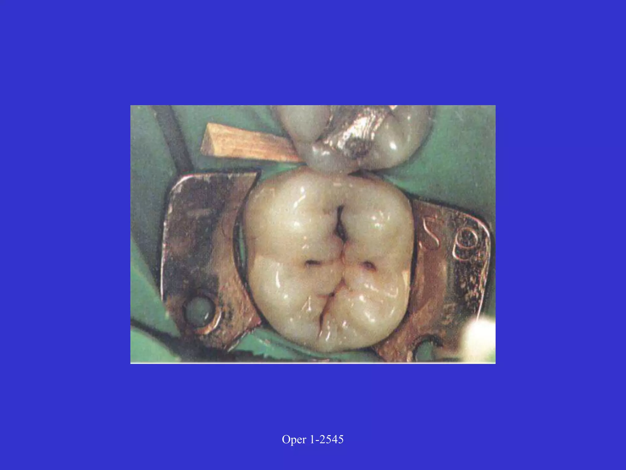 Clinical Diagnosis of Tooth Defects and Treatment Plan.ppt