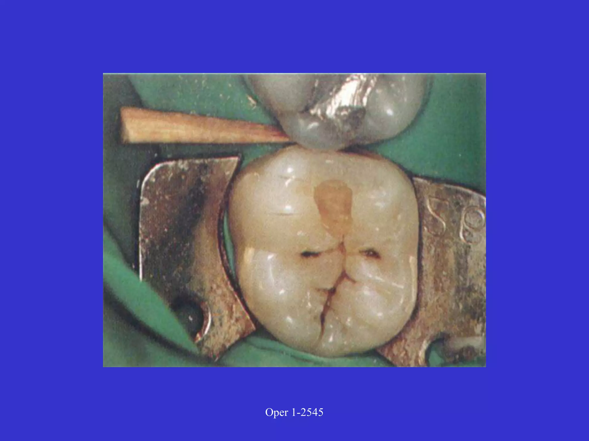 Clinical Diagnosis of Tooth Defects and Treatment Plan.ppt