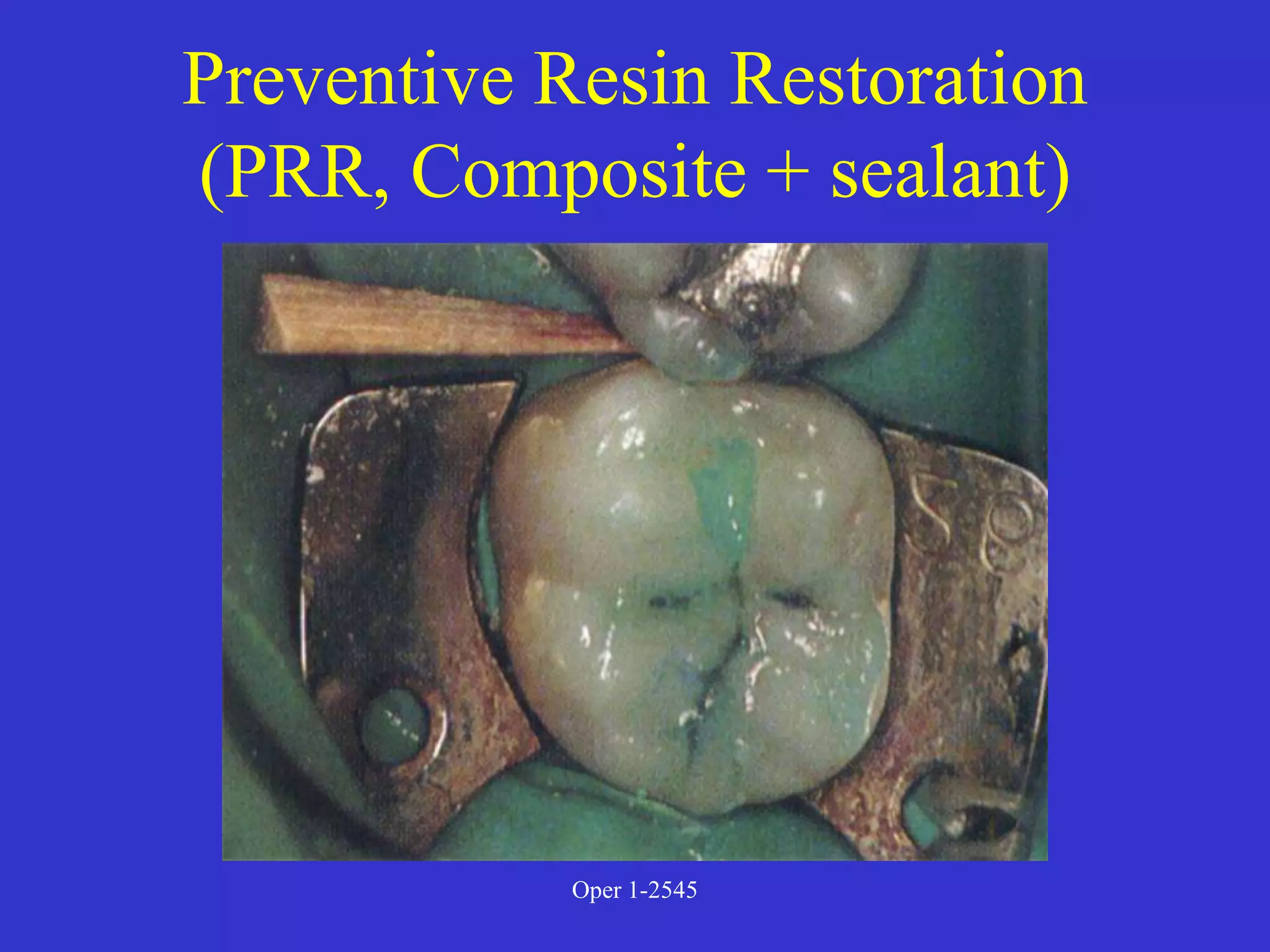 Clinical Diagnosis of Tooth Defects and Treatment Plan.ppt