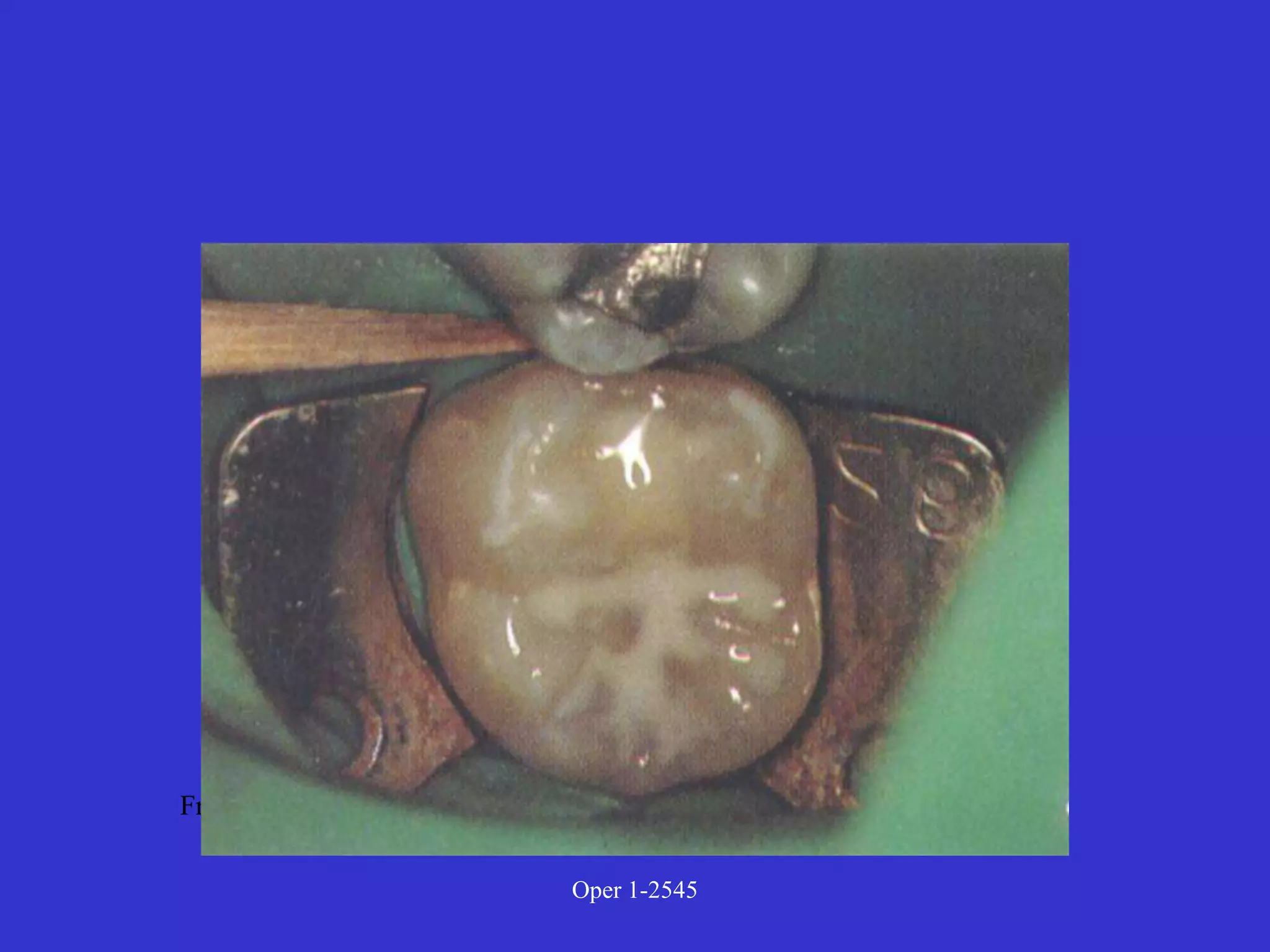 Clinical Diagnosis of Tooth Defects and Treatment Plan.ppt