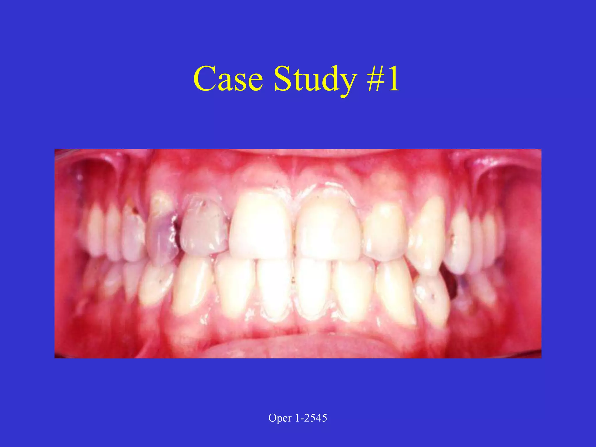 Clinical Diagnosis of Tooth Defects and Treatment Plan.ppt
