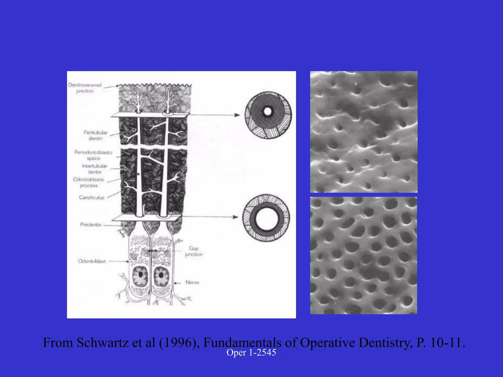 Clinical Diagnosis of Tooth Defects and Treatment Plan.ppt