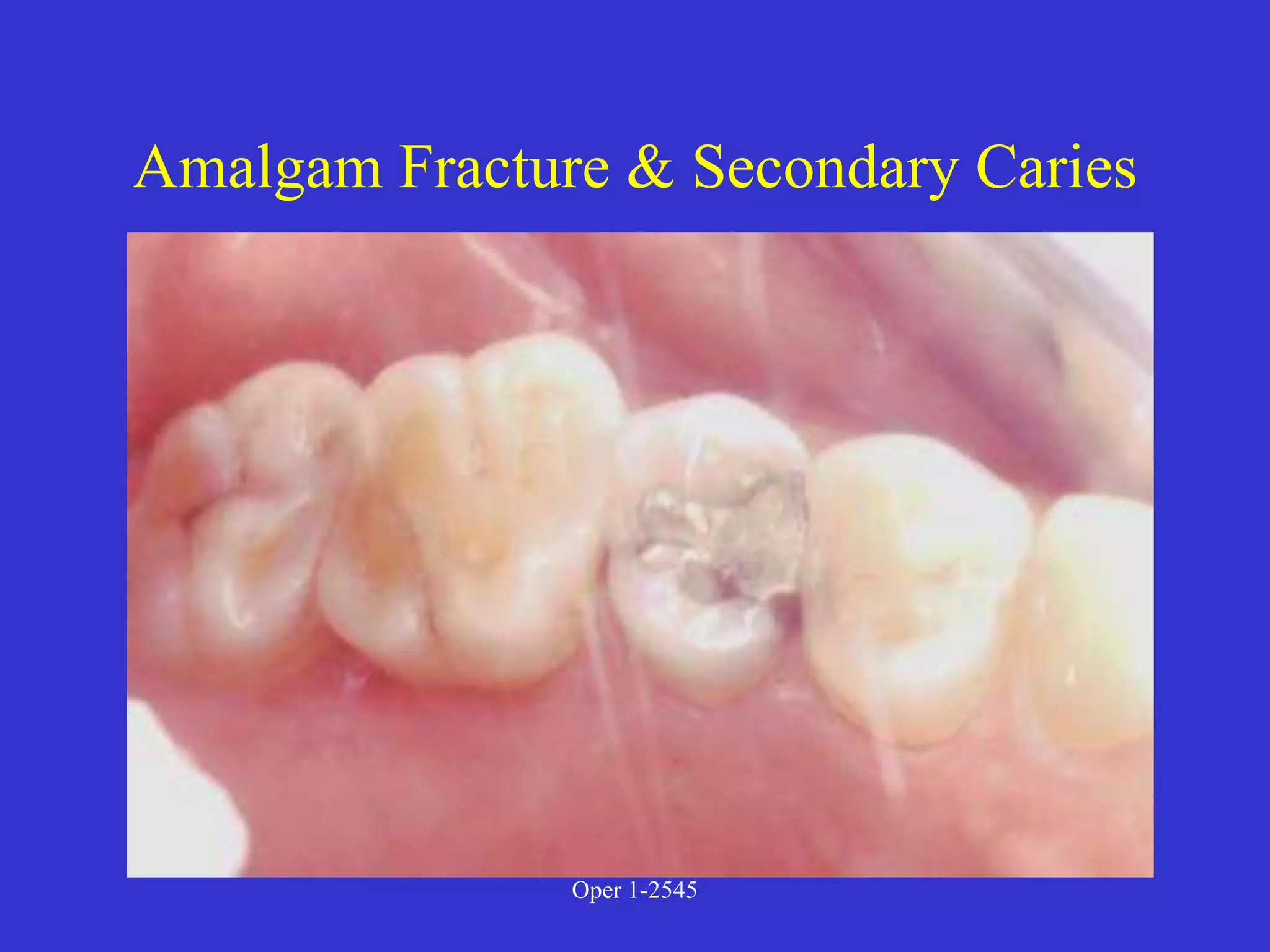 Clinical Diagnosis of Tooth Defects and Treatment Plan.ppt