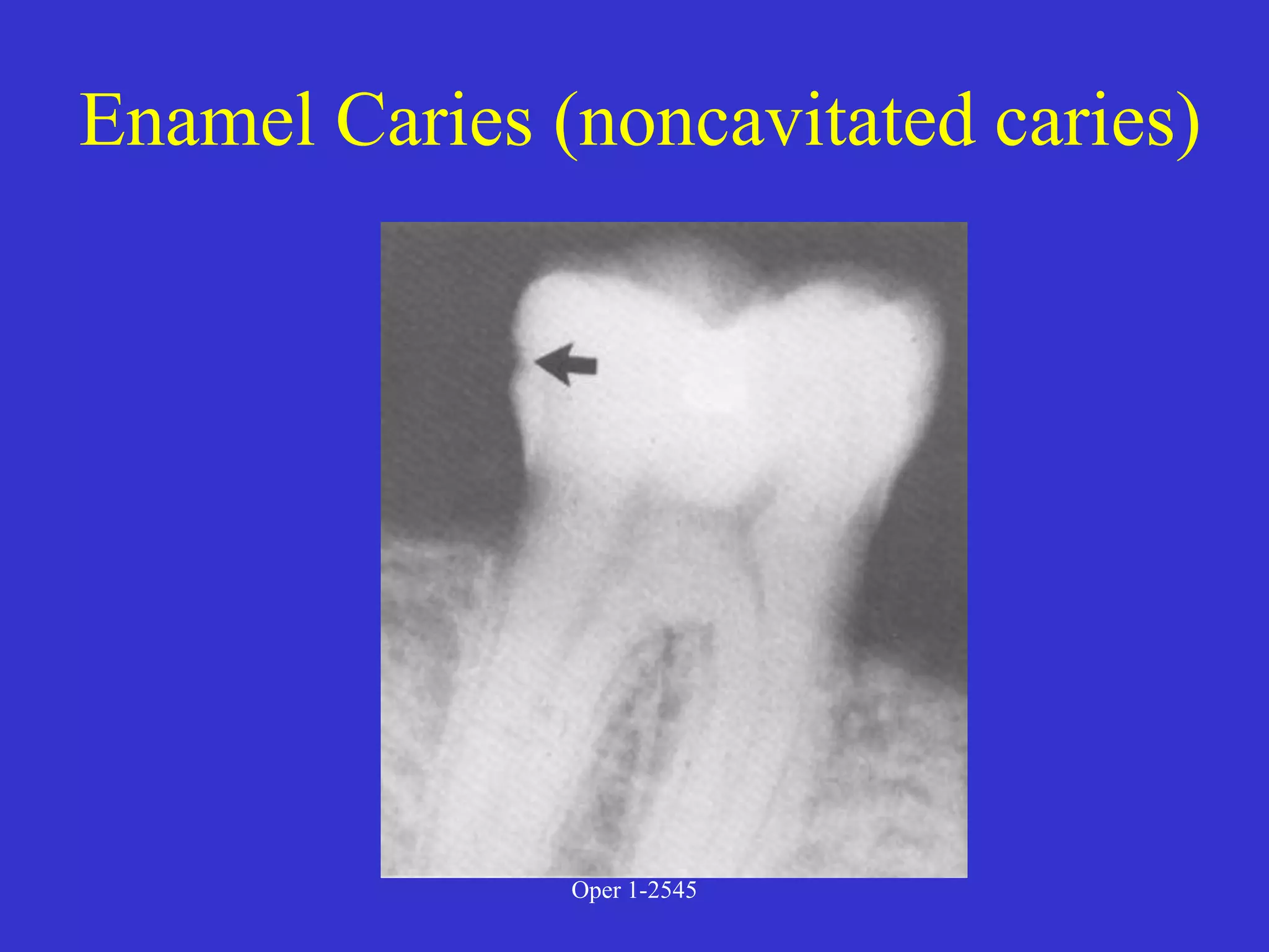 Clinical Diagnosis of Tooth Defects and Treatment Plan.ppt