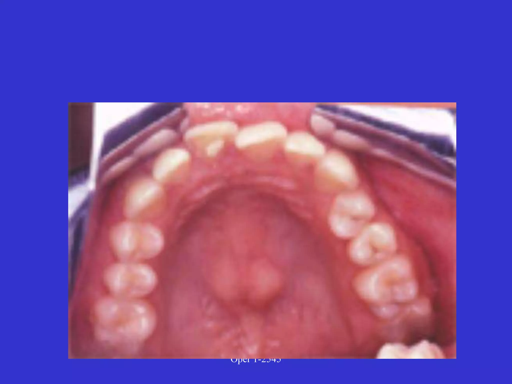 Clinical Diagnosis of Tooth Defects and Treatment Plan.ppt