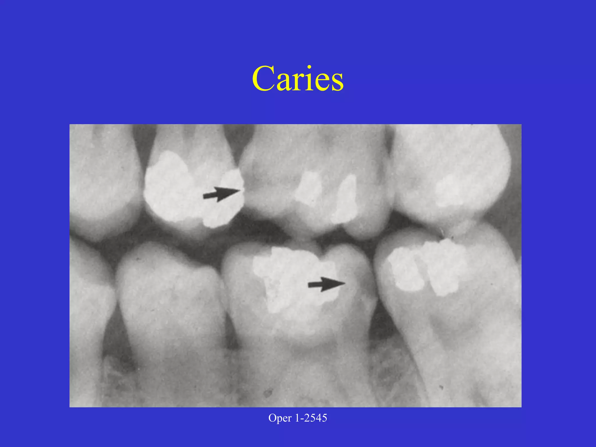 Clinical Diagnosis of Tooth Defects and Treatment Plan.ppt