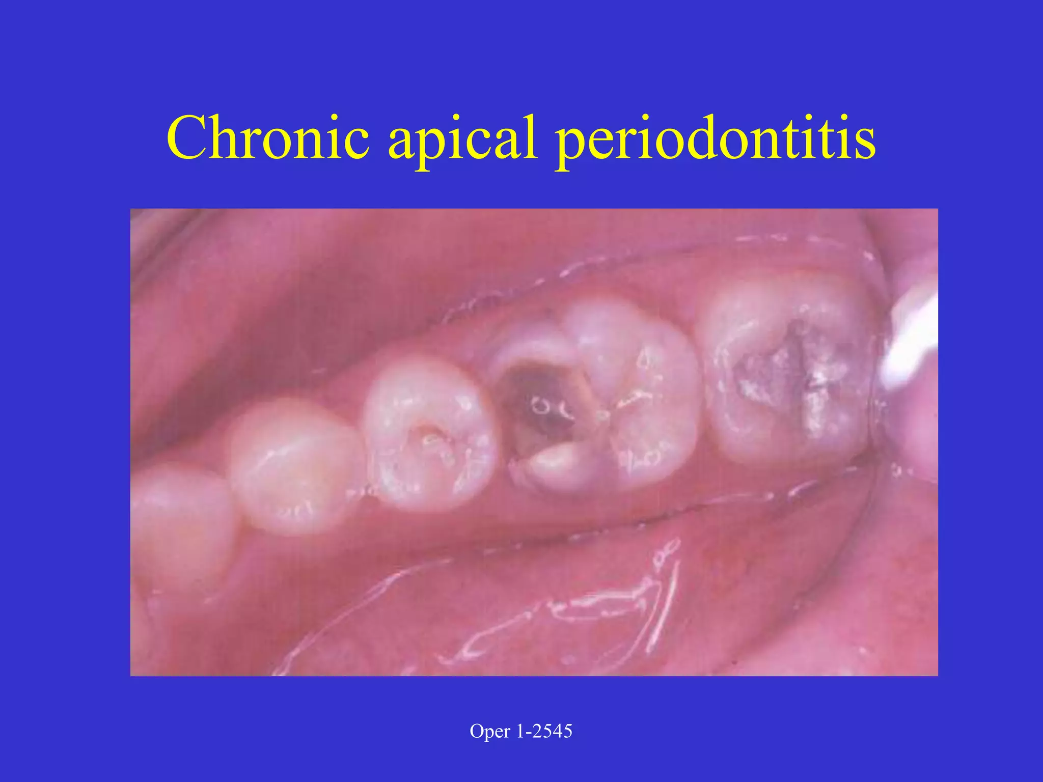 Clinical Diagnosis of Tooth Defects and Treatment Plan.ppt