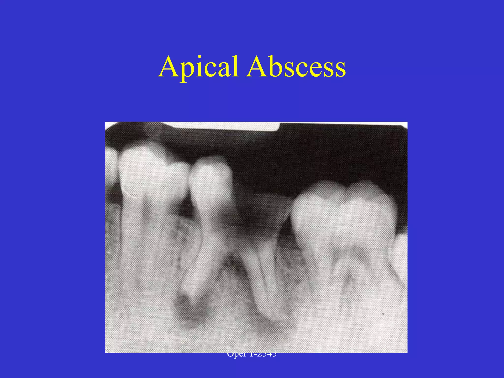 Clinical Diagnosis of Tooth Defects and Treatment Plan.ppt
