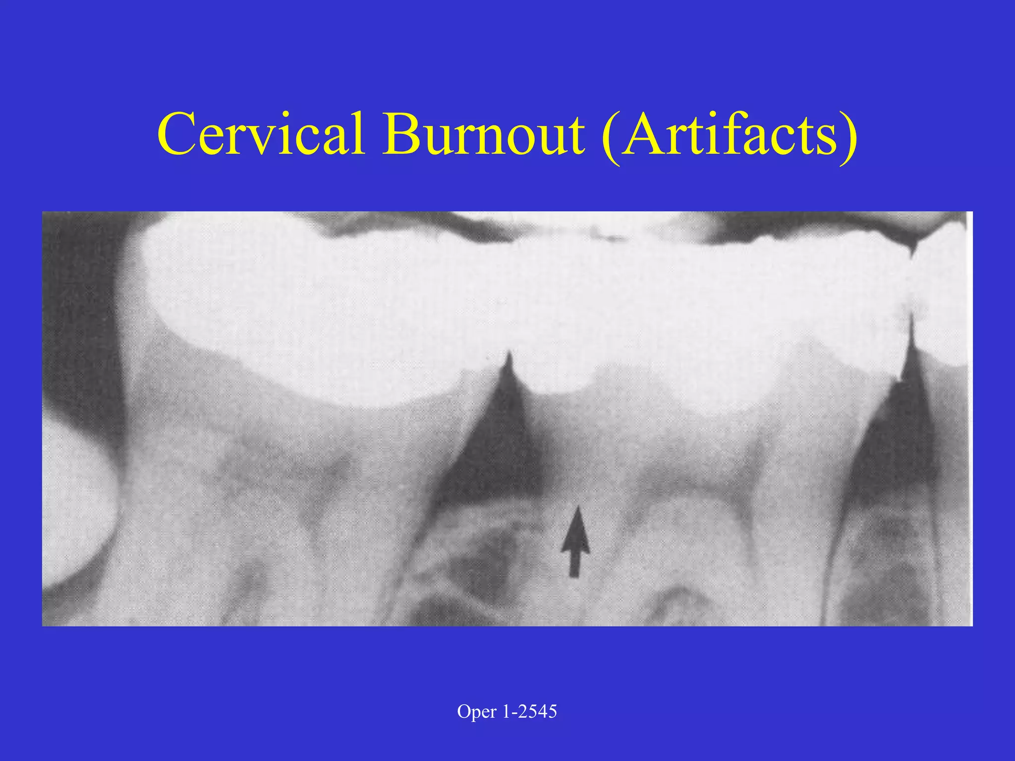 Clinical Diagnosis of Tooth Defects and Treatment Plan.ppt