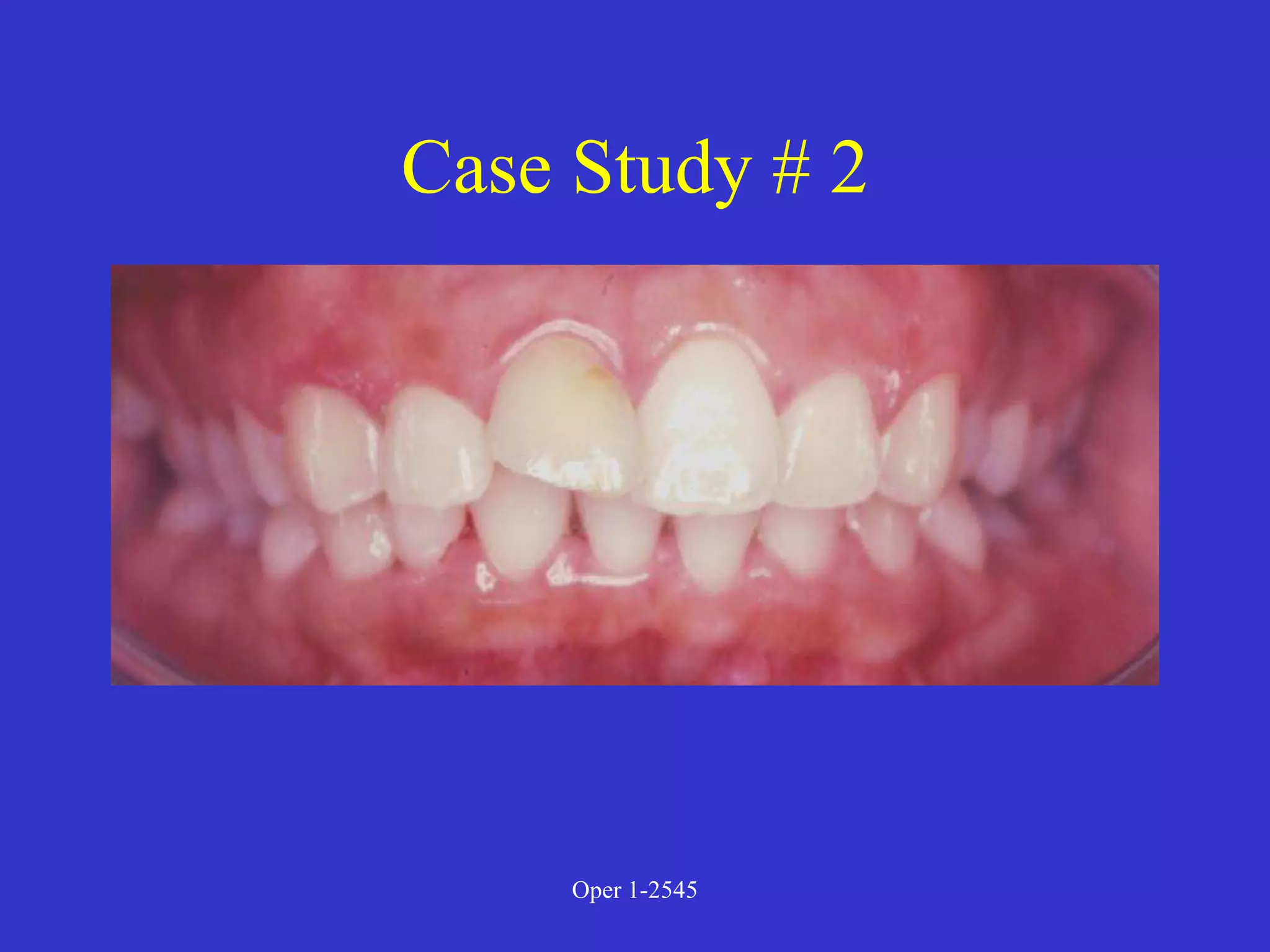 Clinical Diagnosis of Tooth Defects and Treatment Plan.ppt