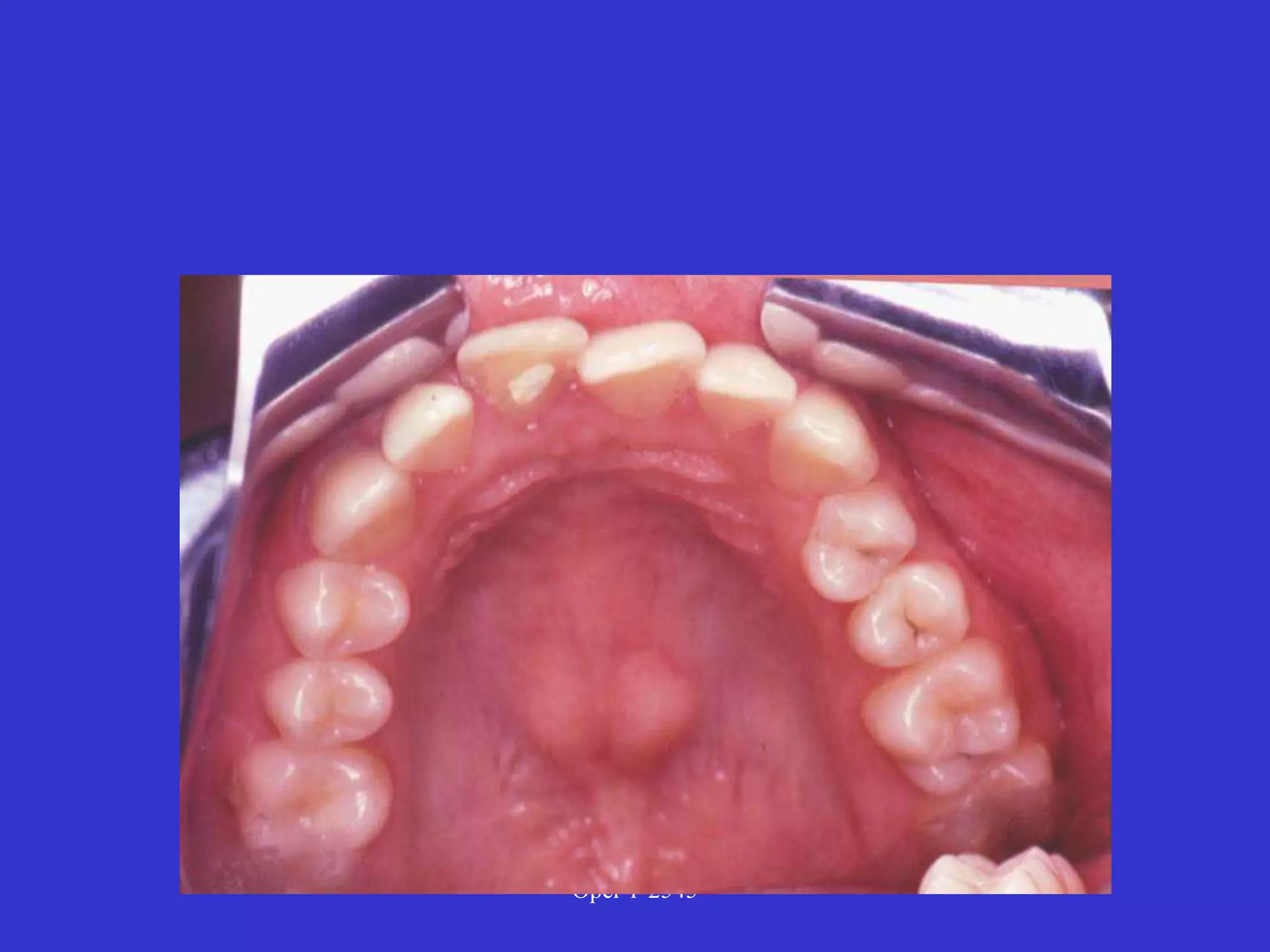 Clinical Diagnosis of Tooth Defects and Treatment Plan.ppt