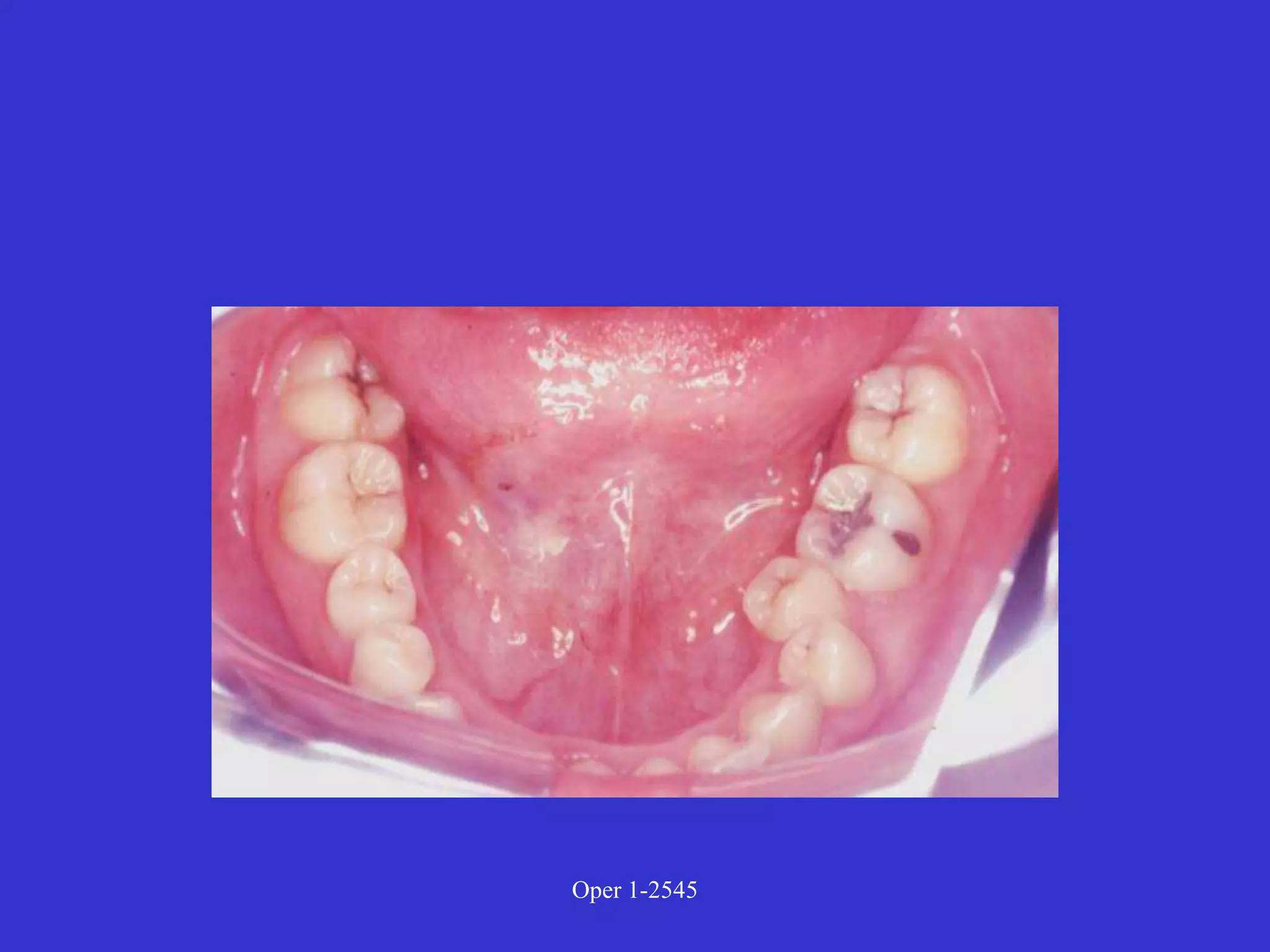 Clinical Diagnosis of Tooth Defects and Treatment Plan.ppt