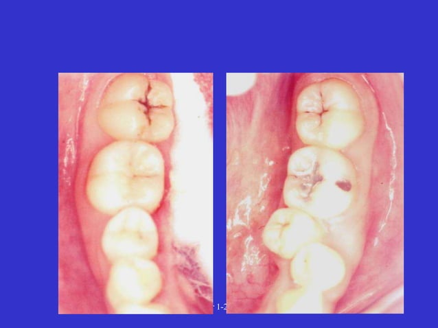 Clinical Diagnosis of Tooth Defects and Treatment Plan.ppt