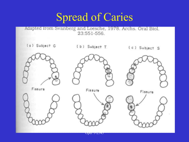Clinical Diagnosis of Tooth Defects and Treatment Plan.ppt