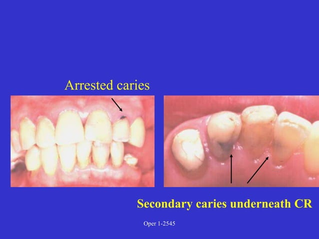 Clinical Diagnosis of Tooth Defects and Treatment Plan.ppt