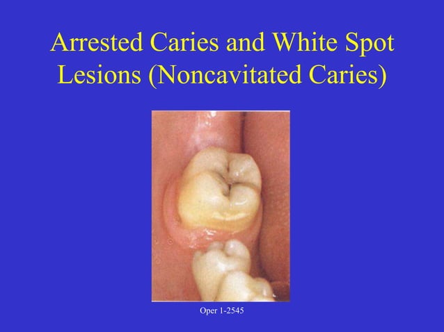 Clinical Diagnosis of Tooth Defects and Treatment Plan.ppt