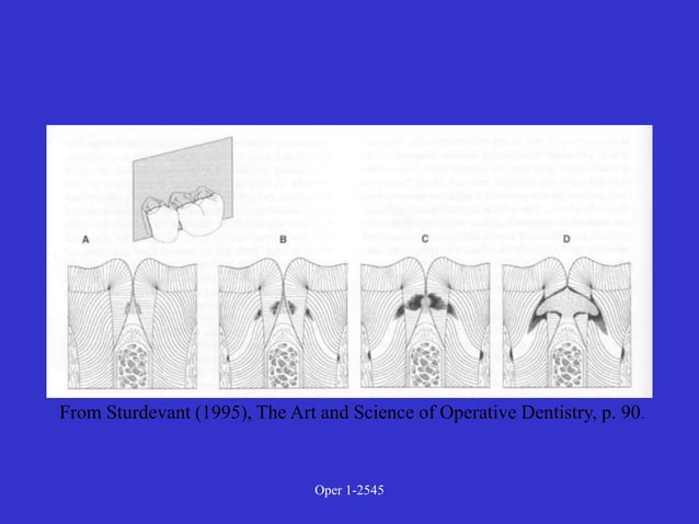 Clinical Diagnosis of Tooth Defects and Treatment Plan.ppt