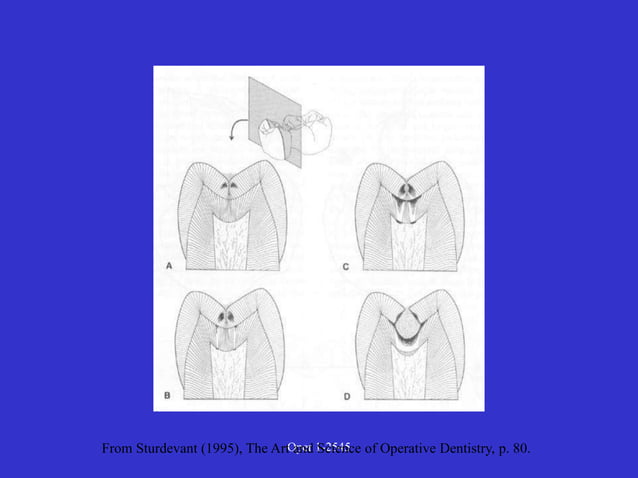 Clinical Diagnosis of Tooth Defects and Treatment Plan.ppt