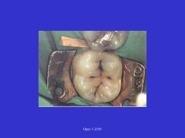 Clinical Diagnosis of Tooth Defects and Treatment Plan.ppt